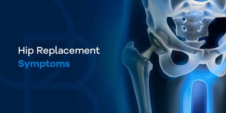 8 Signs To Know If You Need Hip Replacement Surgery