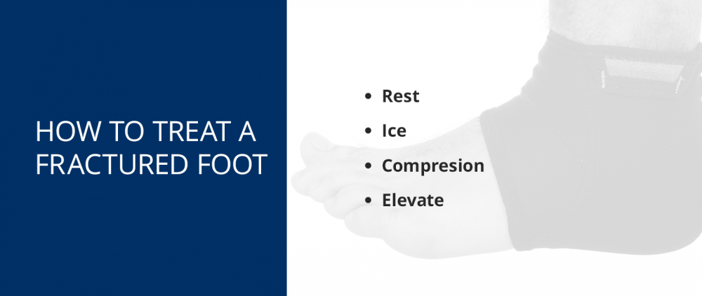 Top of Foot: Treatment Tips for Fracture, Sprain or Strain