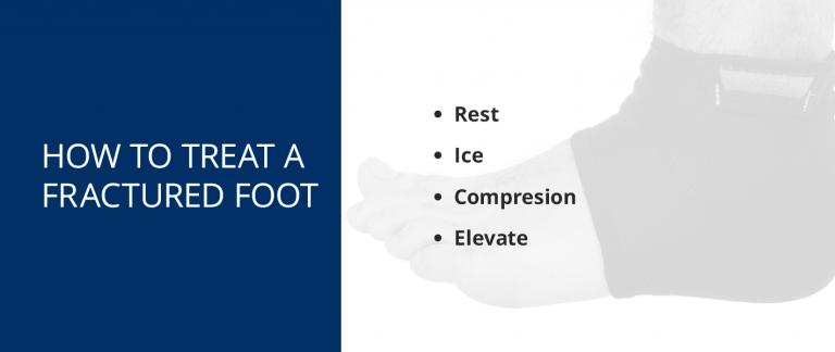 Top of Foot: Treatment Tips for Fracture, Sprain or Strain