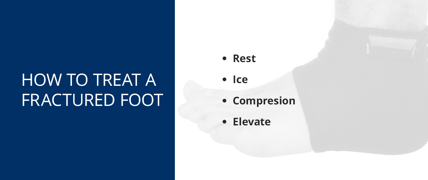 Top of Foot: Treatment Tips for Fracture, Sprain or Strain