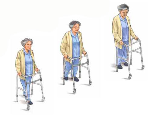 Hip Post-Operative Care Information | OrthoBethesda