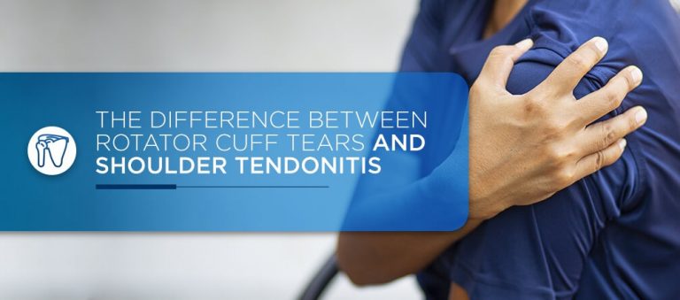 The Difference Between Rotator Cuff Tears & Shoulder Tendonitis
