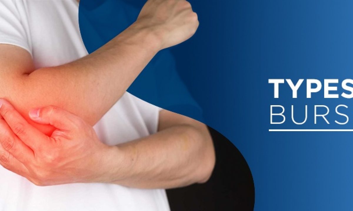 Olecranon Bursitis Presentation And Treatment Bone And Spine