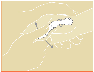 Arthritis Of The Base Of The Thumb in Bethesda & DMV Area