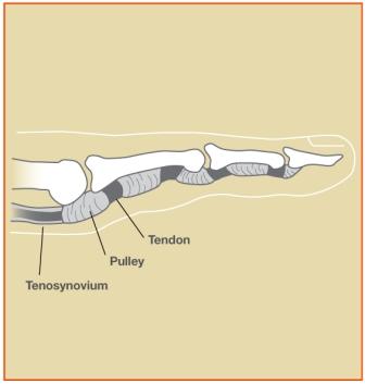 Trigger Finger Treatment in Bethesda MD | OrthoBethesda