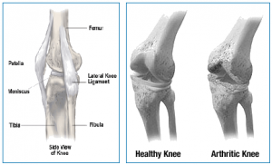 Orthopedic Knee Treatment in Bethesda, MD | Ortho Bethesda
