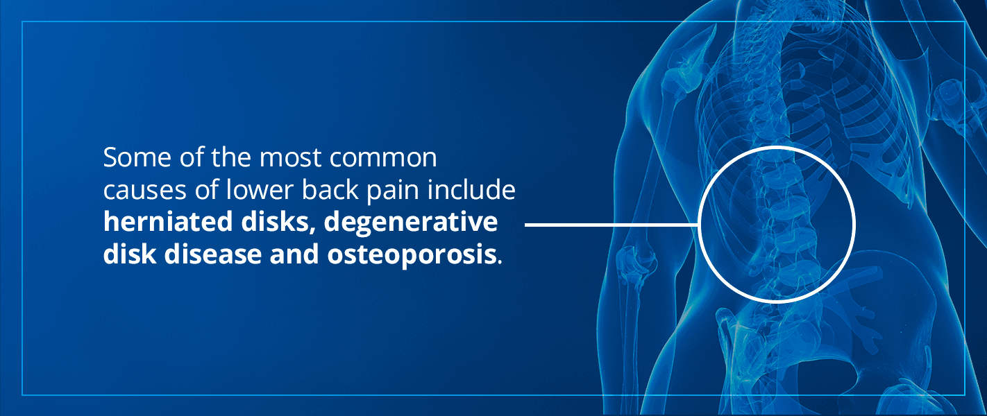 How to Reduce Low Back Pain | OrthoBethesda