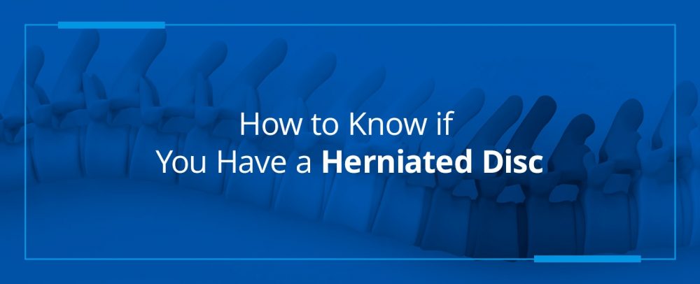 How to Know if You Have a Herniated Disc | OrthoBethesda