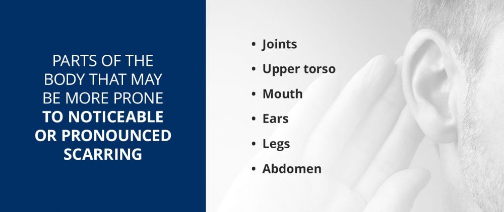 Everything You Need to Know About Surgical Scarring